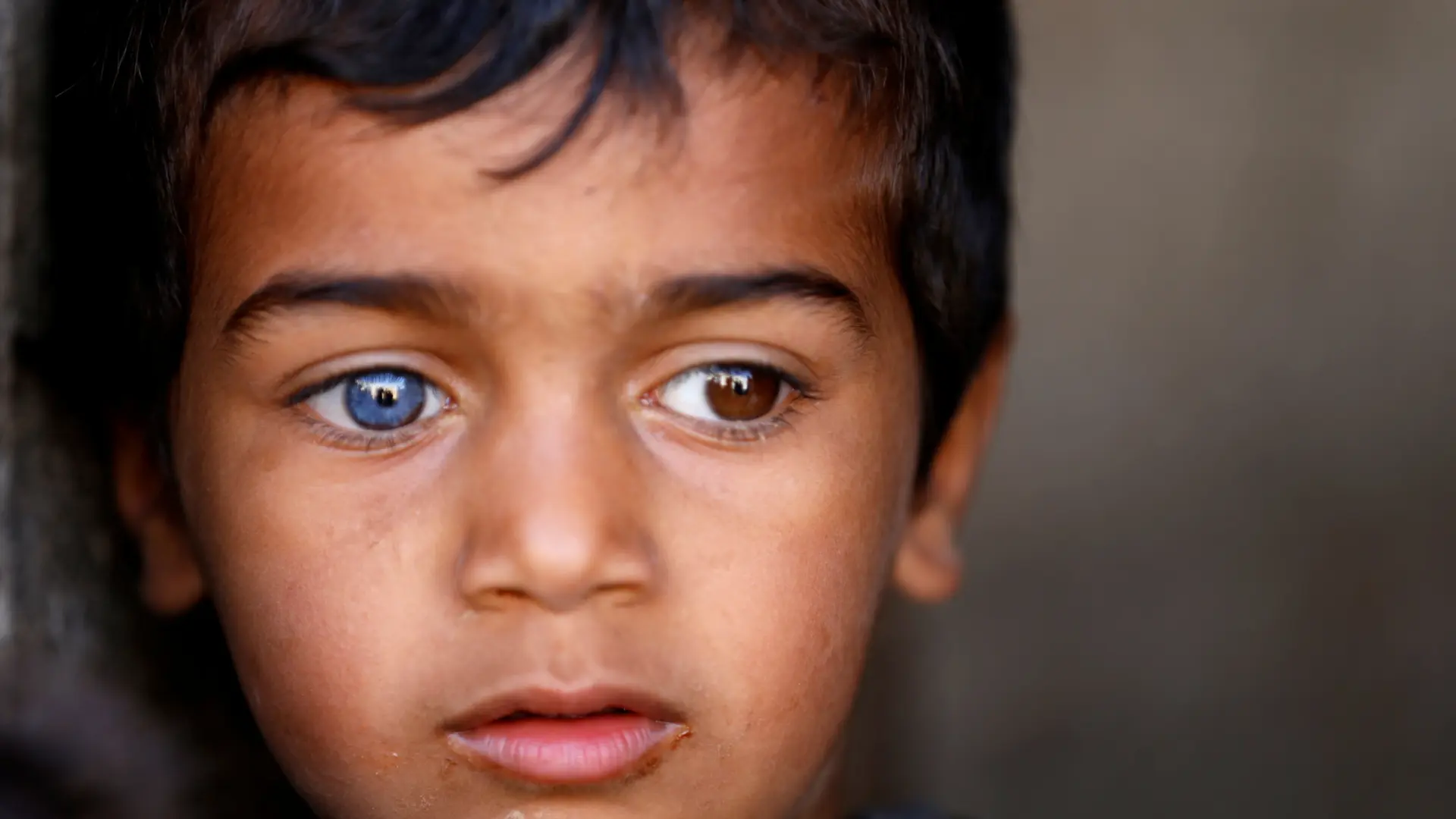 Estos son los 6 colores de ojos más raros del mundo